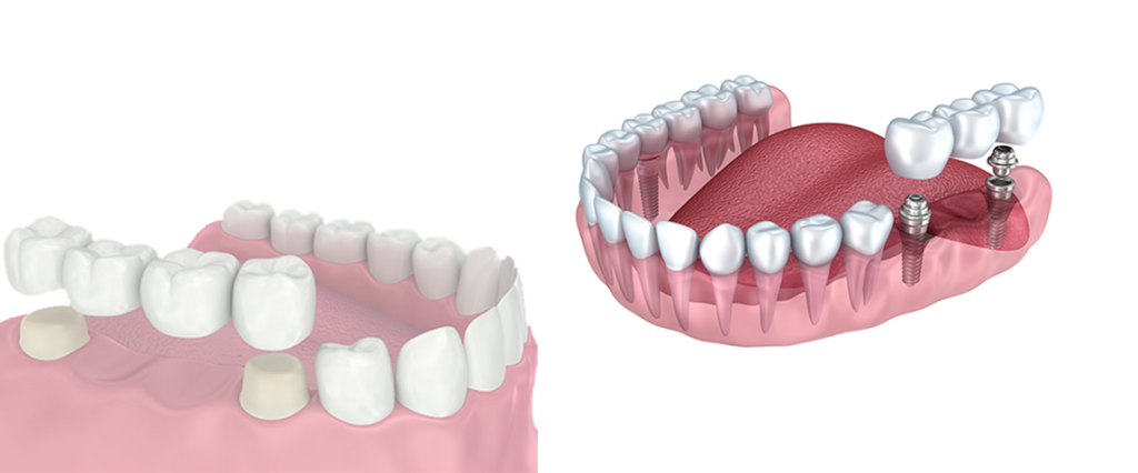 Services – Goldthorn Dental Practice